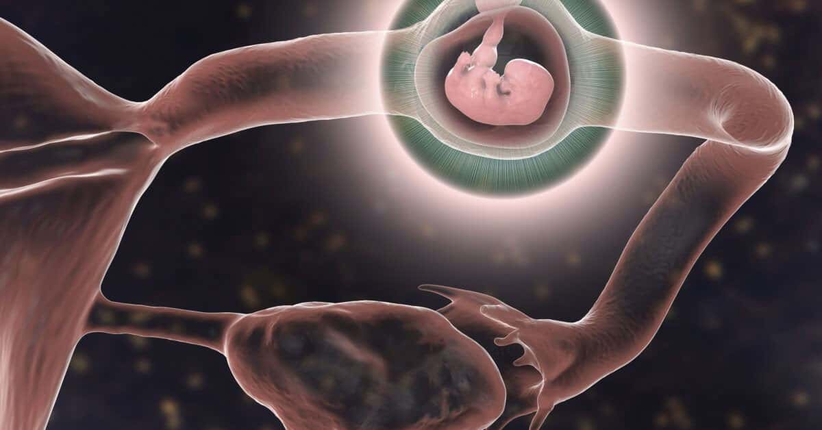 Ultrassonografia Transvaginal Gravidez Ectopica Clínica Da Mulher